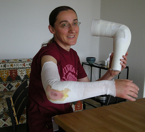 Der gespaltene «Gips»